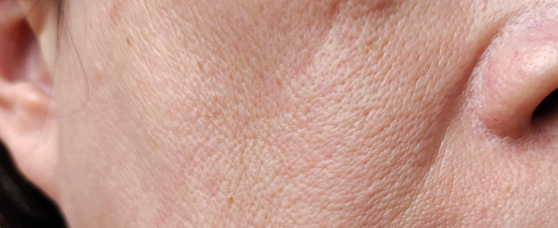 2026 Blogs | Dallas Surgical Arts