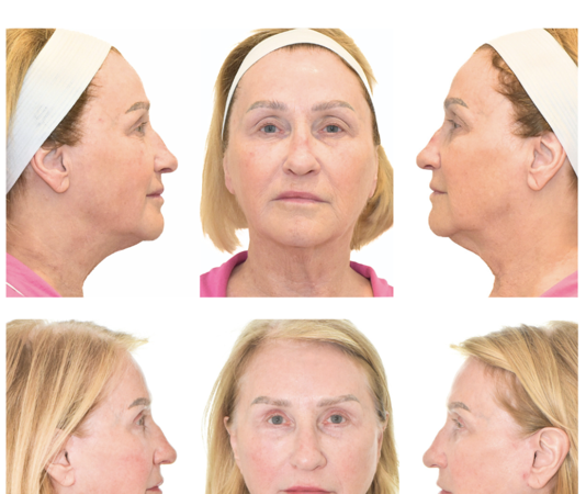 2024 Blogs | Dallas Surgical Arts