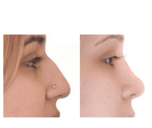April 2023 Blogs | Dallas Surgical Arts