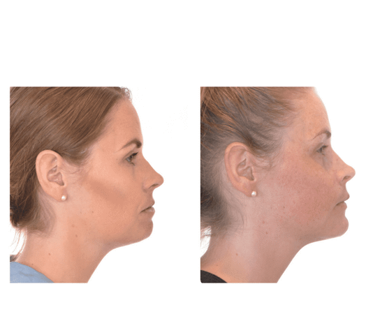 February 2023 Blogs | Dallas Surgical Arts