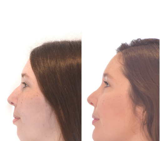 October 2023 Blogs | Dallas Surgical Arts