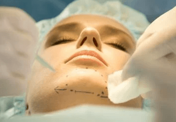 Answering the Top Questions about Chin Reshaping Surgery