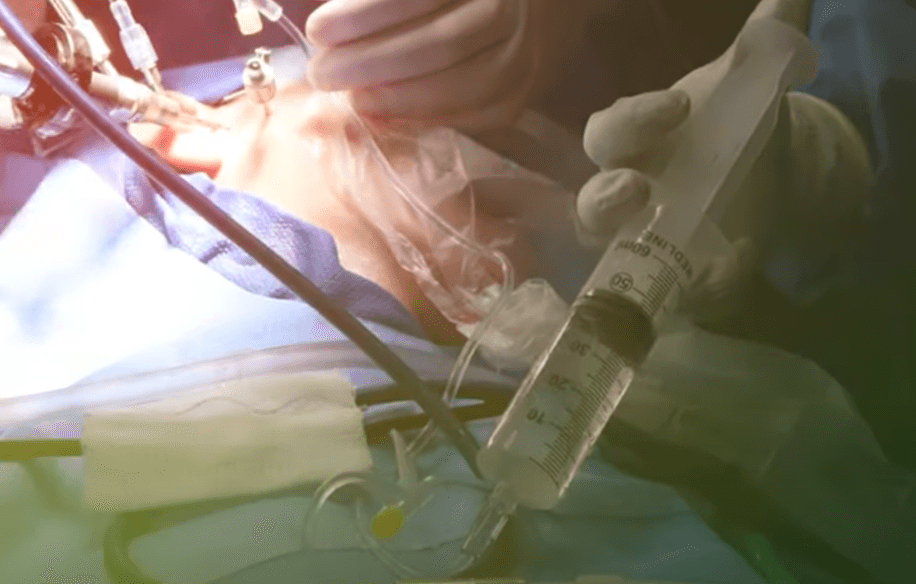 Dallas Arthroscopy TMJ Recovery - Get Pain Relief at Dallas Surgical Arts