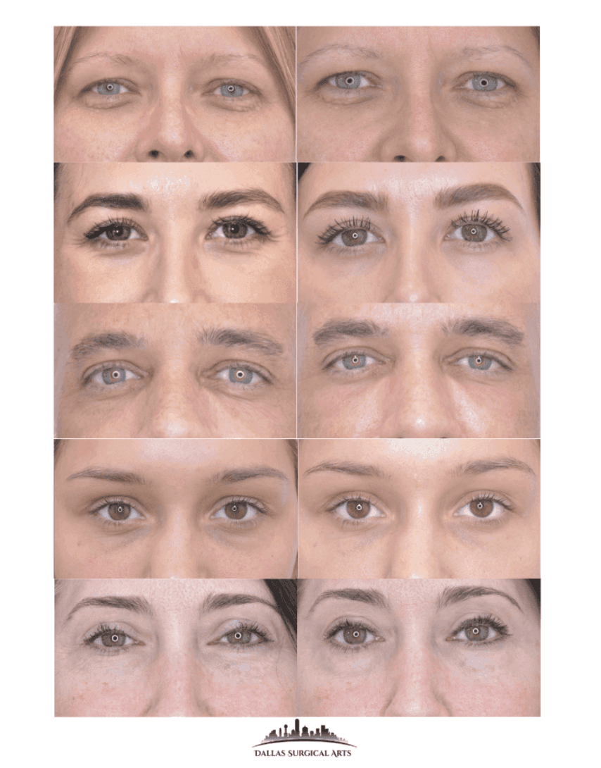 Anti-Aging Treatments for Gen Z in Dallas by Dr. Randy Sanovich