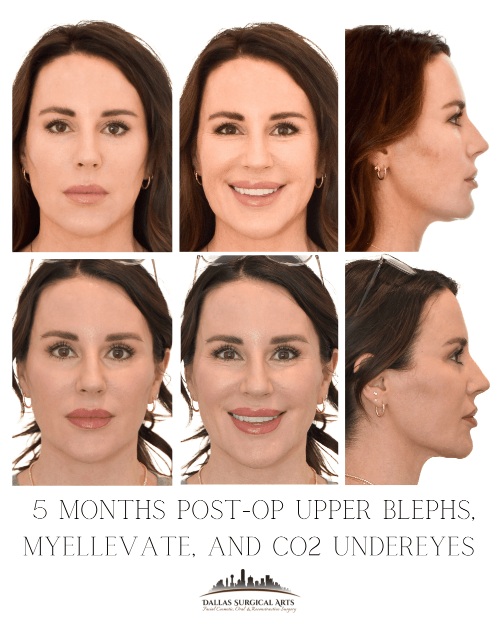 MyEllevate | Dallas Surgical Arts