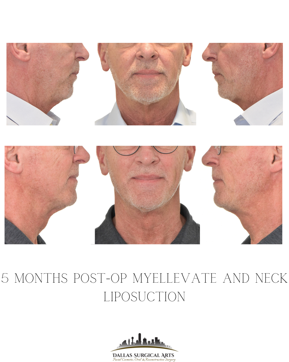 MyEllevate | Dallas Surgical Arts