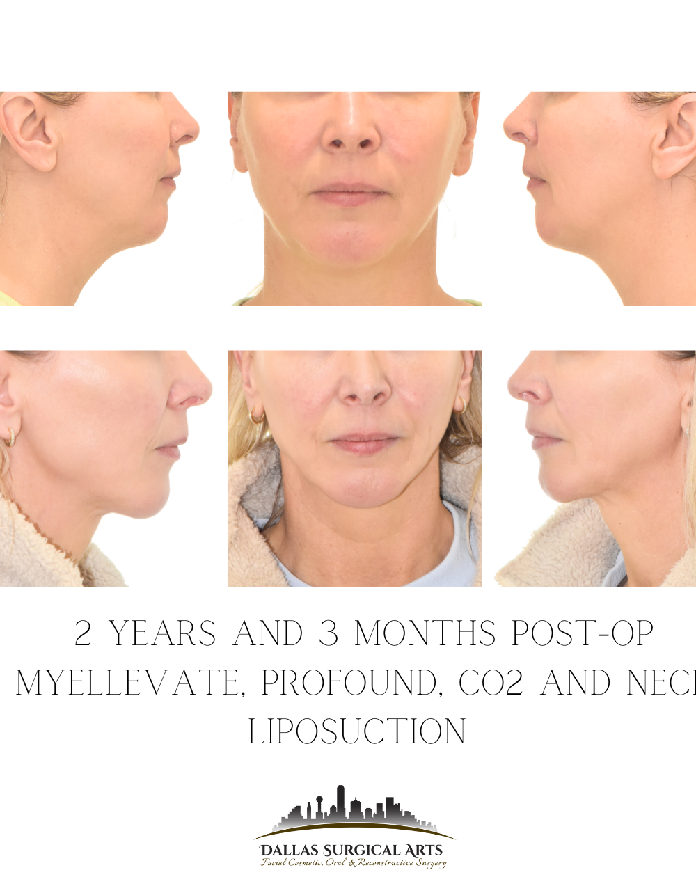 MyEllevate | Dallas Surgical Arts